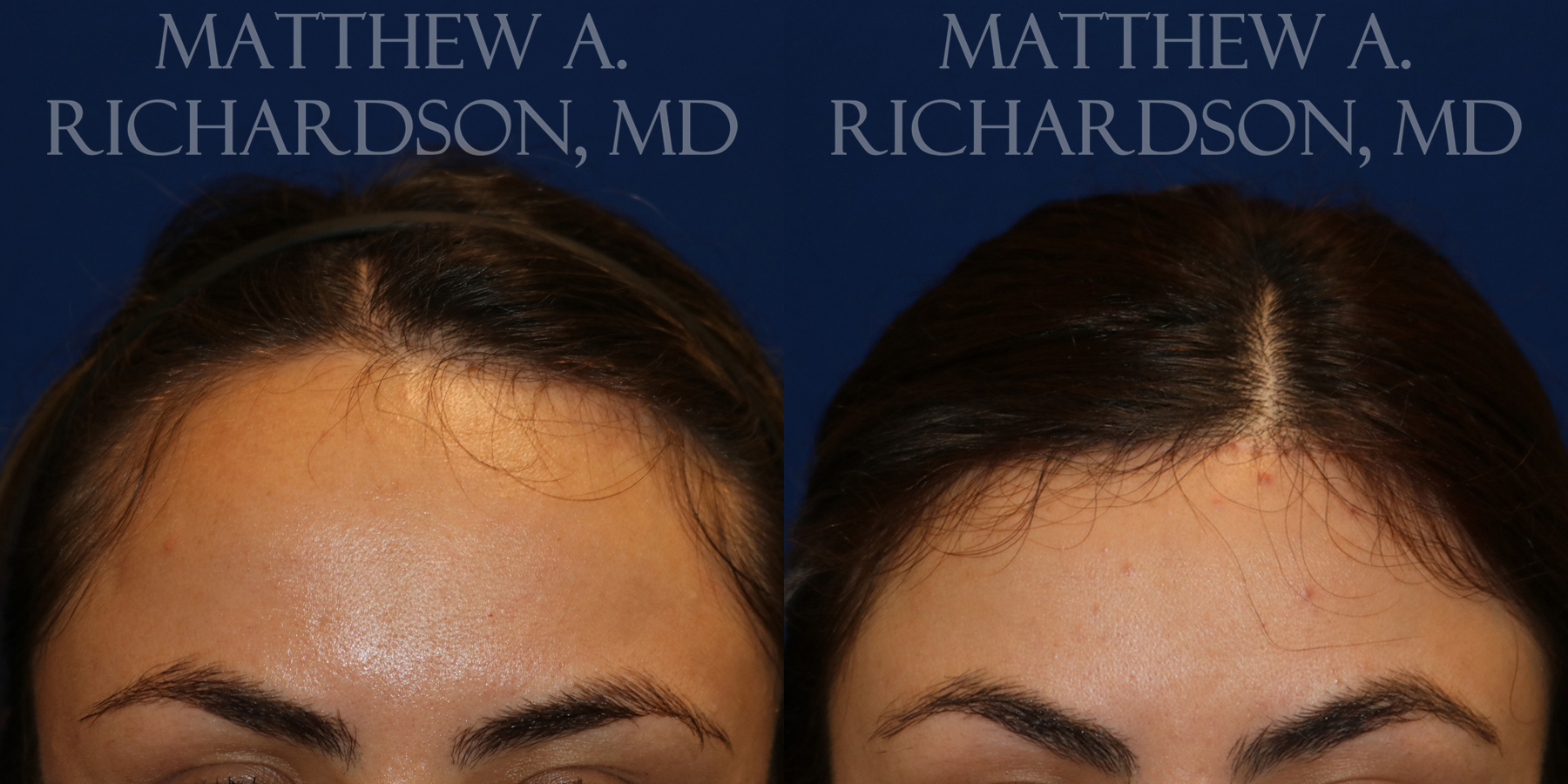 254232 | Texas Facial Aesthetics