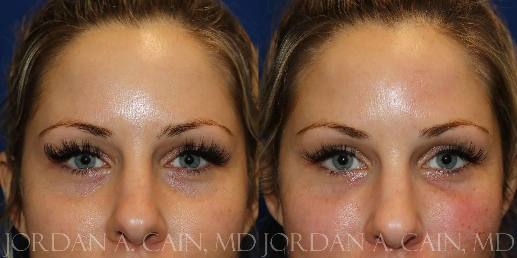 255815 | Texas Facial Aesthetics